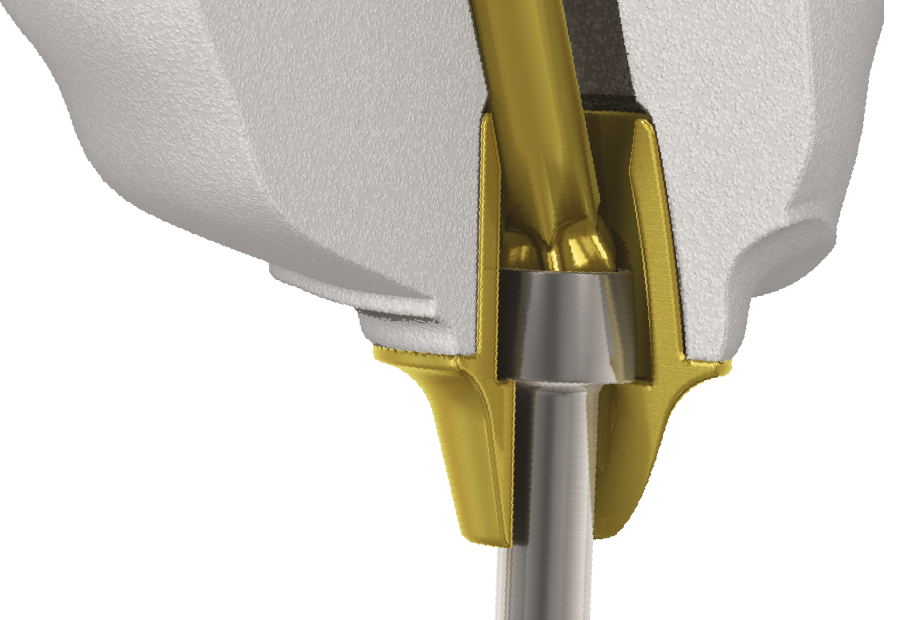 Screwdriver 30mm angulated screw channels