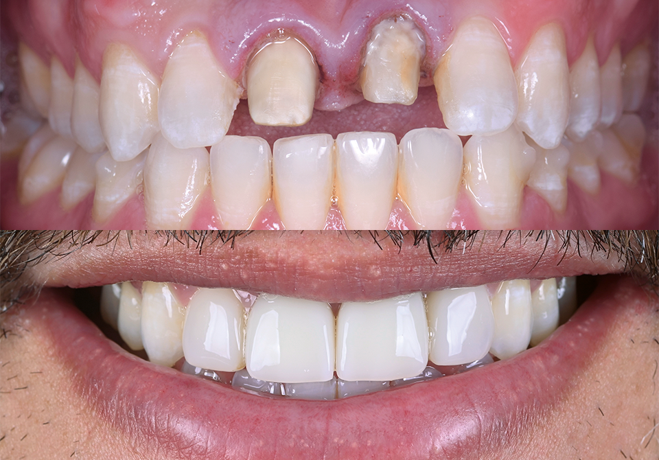 Grandio universal blocks No12 A2 LT, 5 pcs