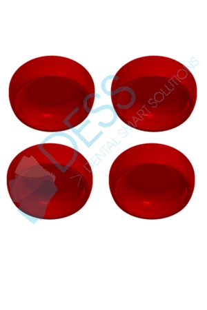 DESS Locator® Retention Kit