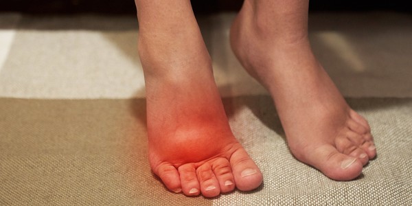 Turvonneet jalat - MedicOnline.fi