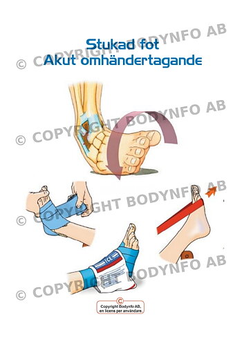 Stukad Fot - Bodynfo