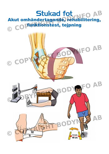 Stukad Fot - Bodynfo