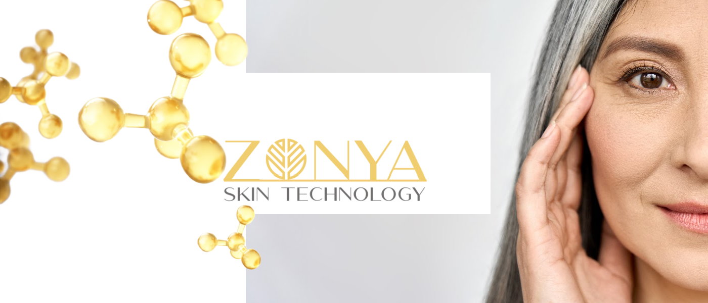 Zonya - Tree of Brands