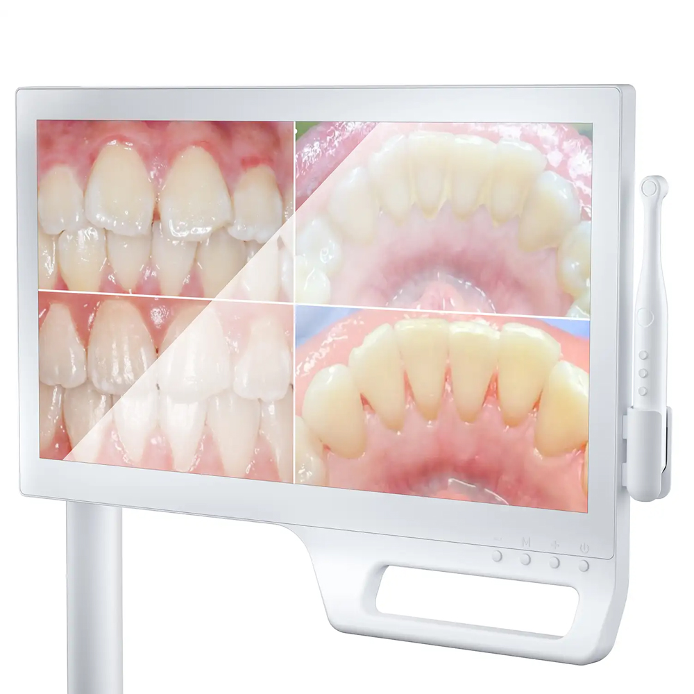 klardent.se - KP CAM Android TOUCH SCREEN Intraoral Camera