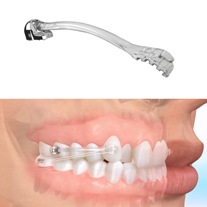 klardent.se - Carriere® Motion 3D Clear Class II 25mm, 2st