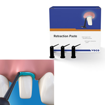 klardent.se - VOCO® Retraction Paste, 25x0,3g