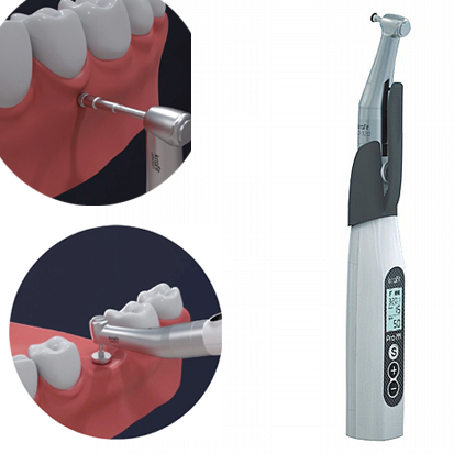 klardent.se - PRO M CLASS® Wireless Screw Driver