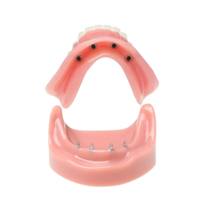 klardent.se - 3M® MDI Mini implantat modell