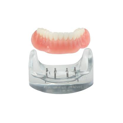 klardent.se - 3M® MDI Mini implantat modell